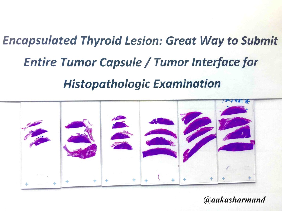Pathology Outlines - Grossing