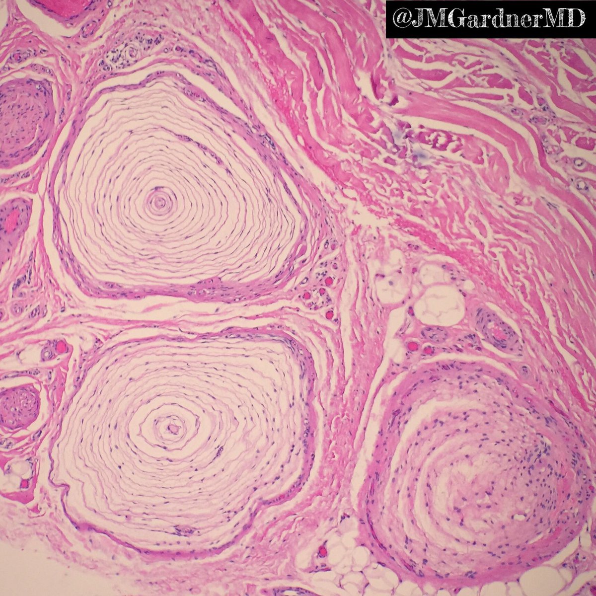Pacinian Corpuscle