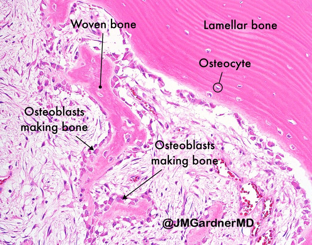 Bone Remodeling Histology