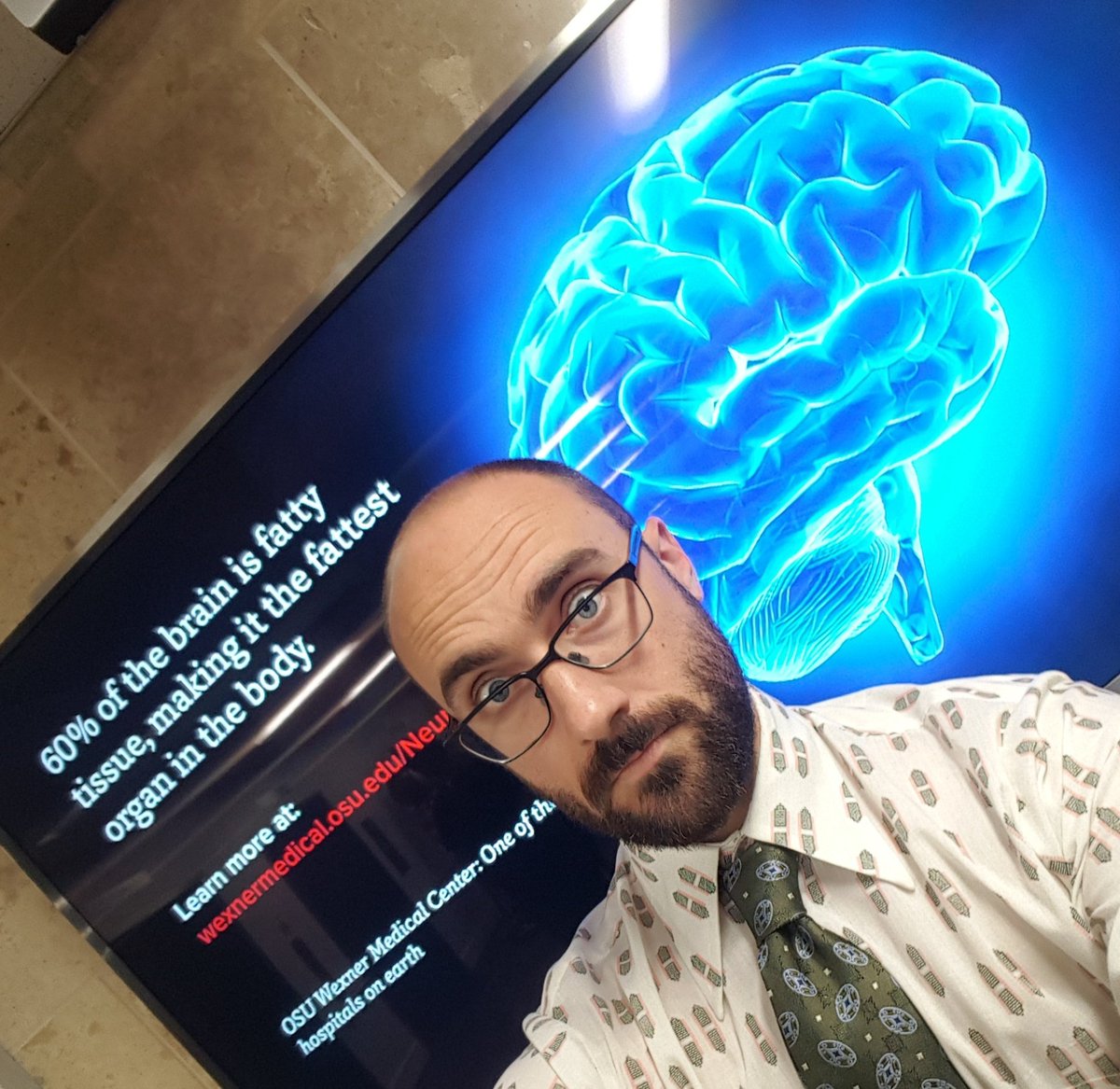 The brain is the fattiest human organ dry brain tissue is 60 fat and ...