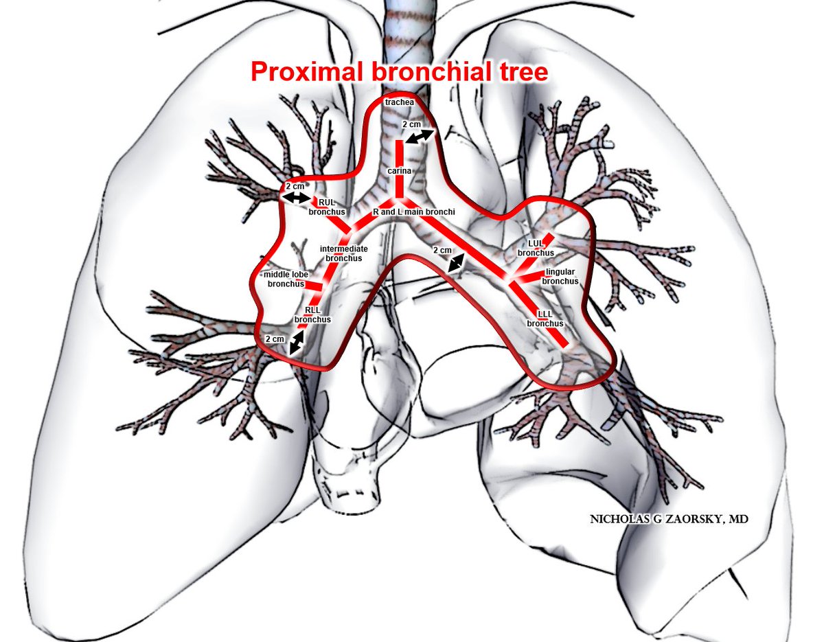 Intermediate Bronchus