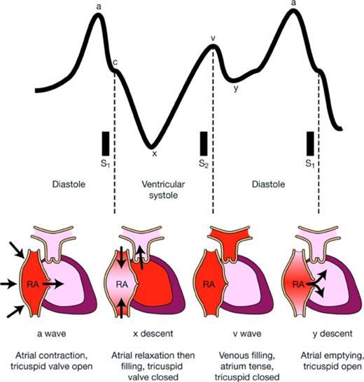 Ventricular Systole