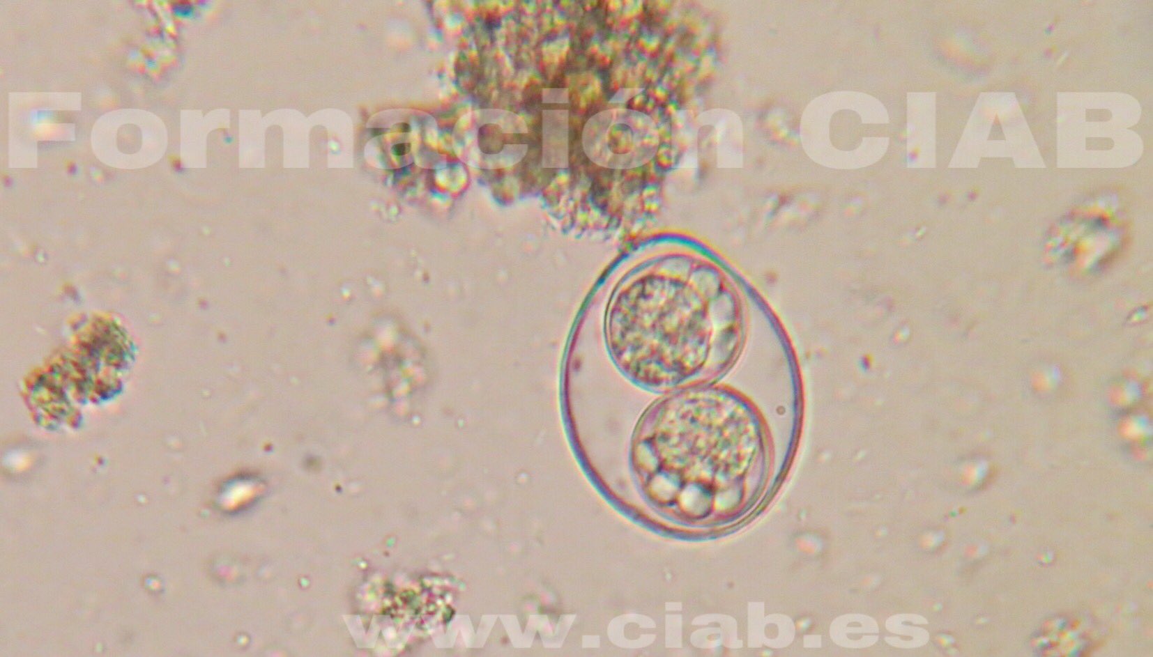 Isospora Felis