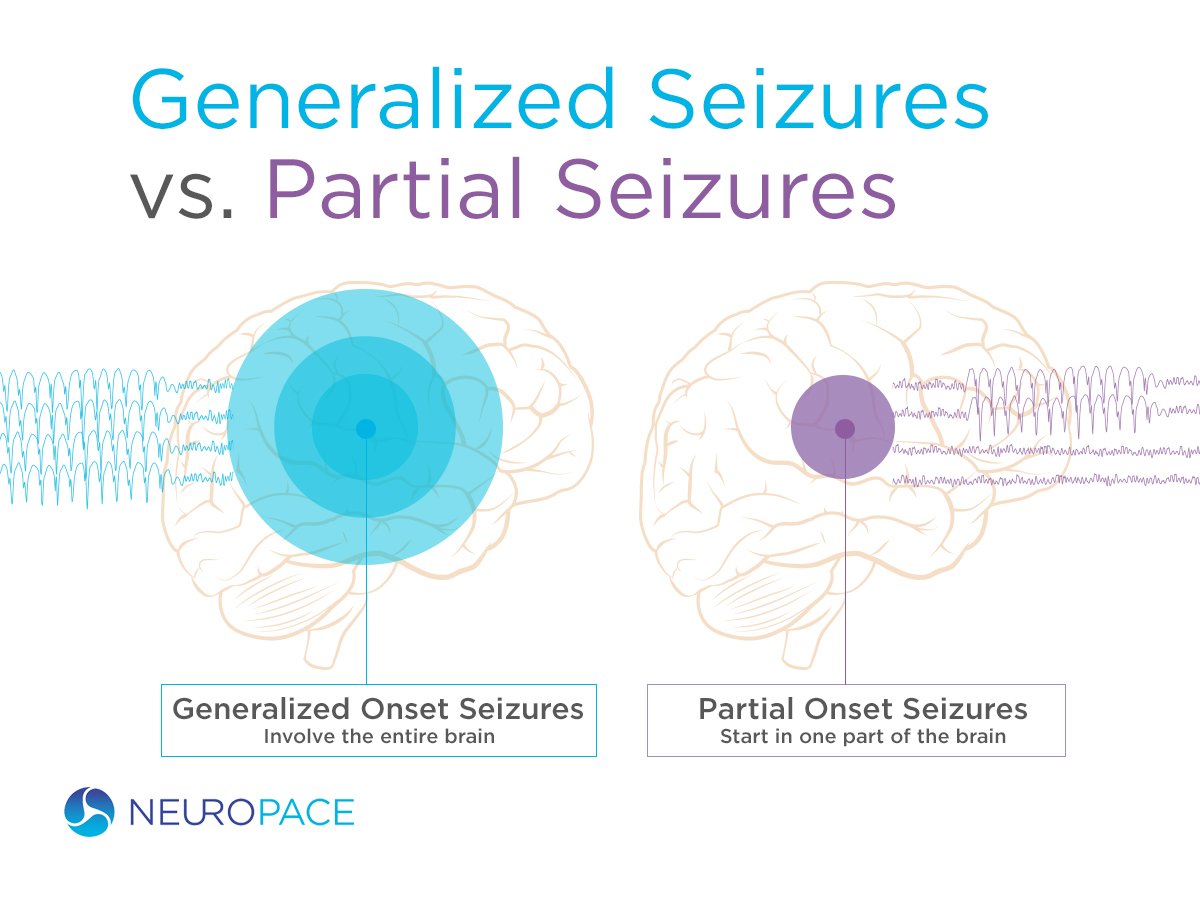 Generalized Seizures