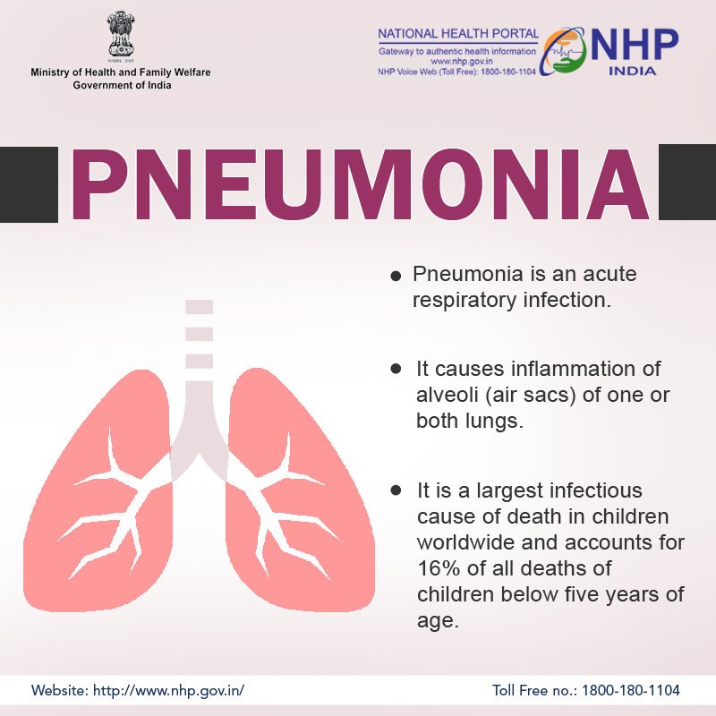 Pneumonia In Children Ppt