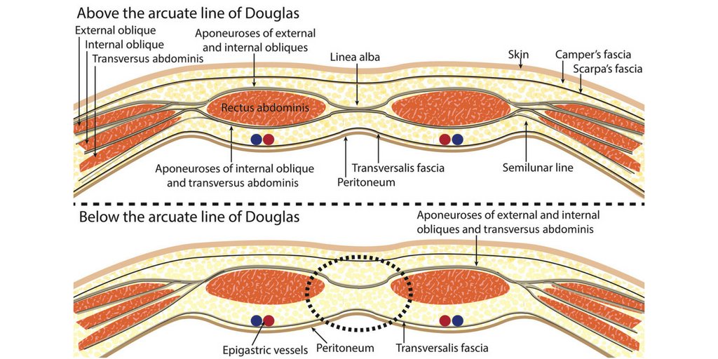 Arcuate Line Abdomen