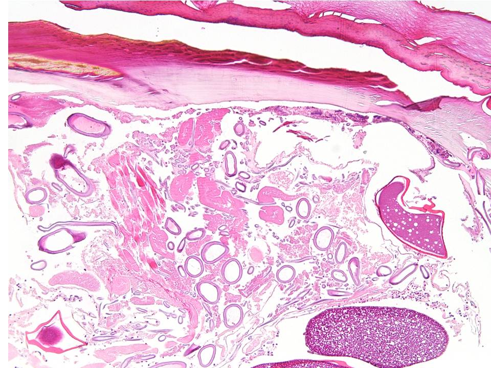 Tunga Penetrans Histology