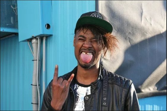 Danny Brown Teeth Fixed