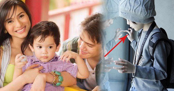 Jennylyn Mercado Son Autistic