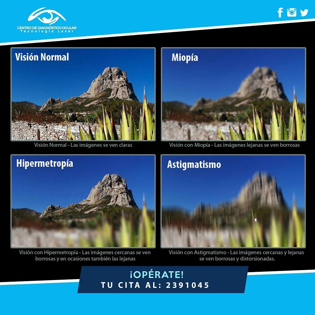 Sintético 101 Foto Como Mira Una Persona Con Miopia El último