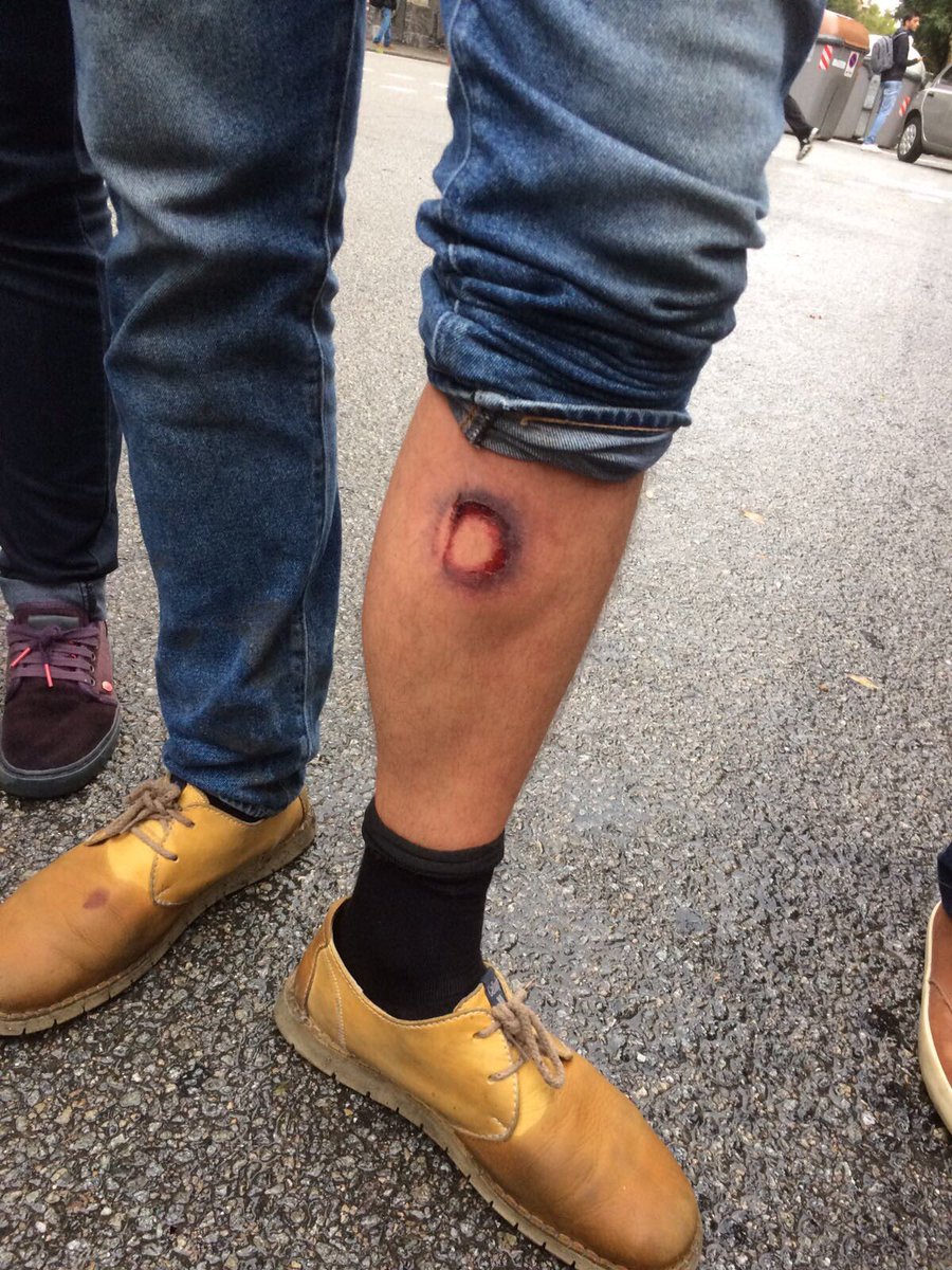 Spanish police violence against Catalan voters | Dear Kitty. Some blog
