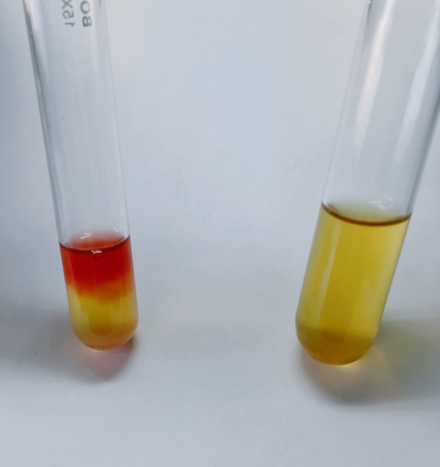 Voges Proskauer Test