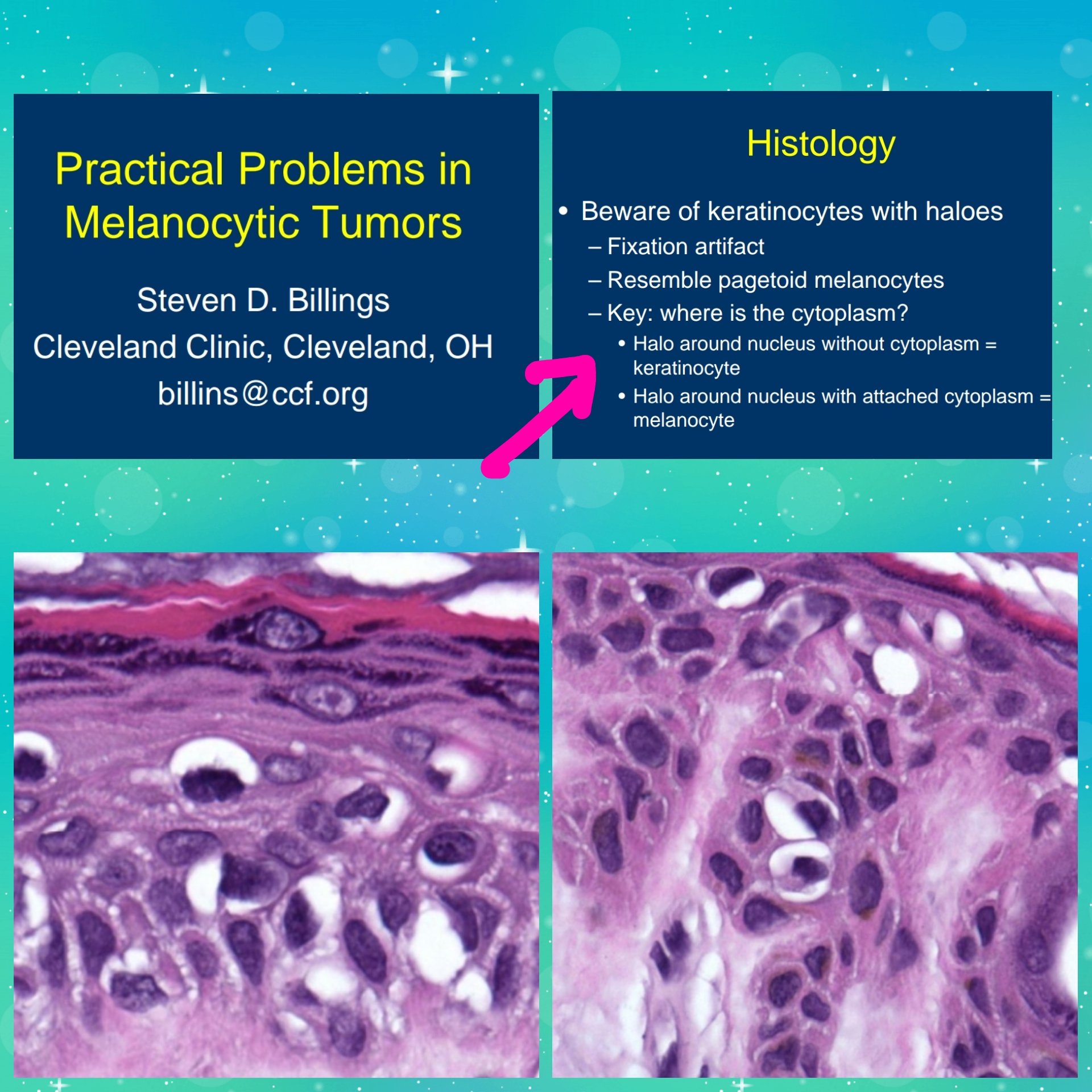 Melanocyte Histology