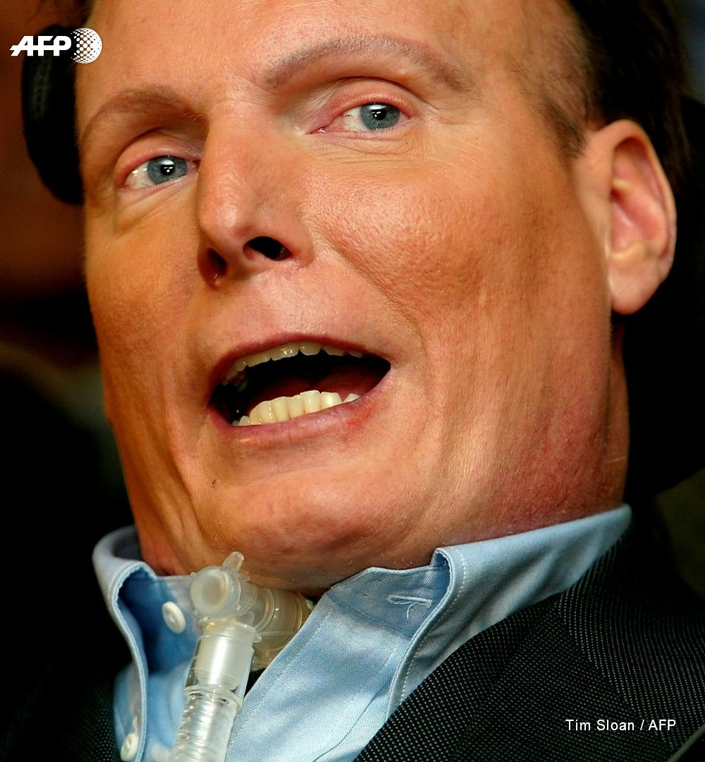 Superman Christopher Reeve Accident