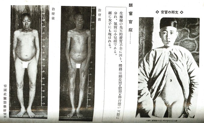 【去勢の歴史】 どちらも非常に有名ですが、衛生展覧会では人為的な去勢と類 戸桝有馬 さんのマンガ ツイコミ仮