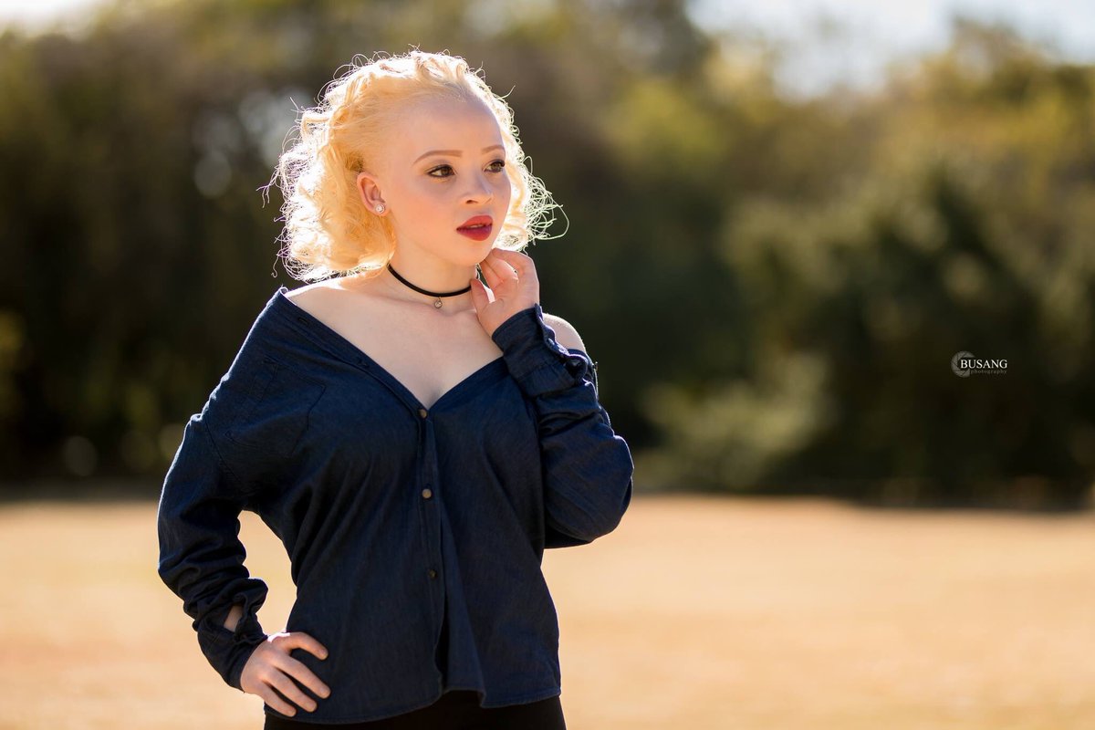 South African Albino Model