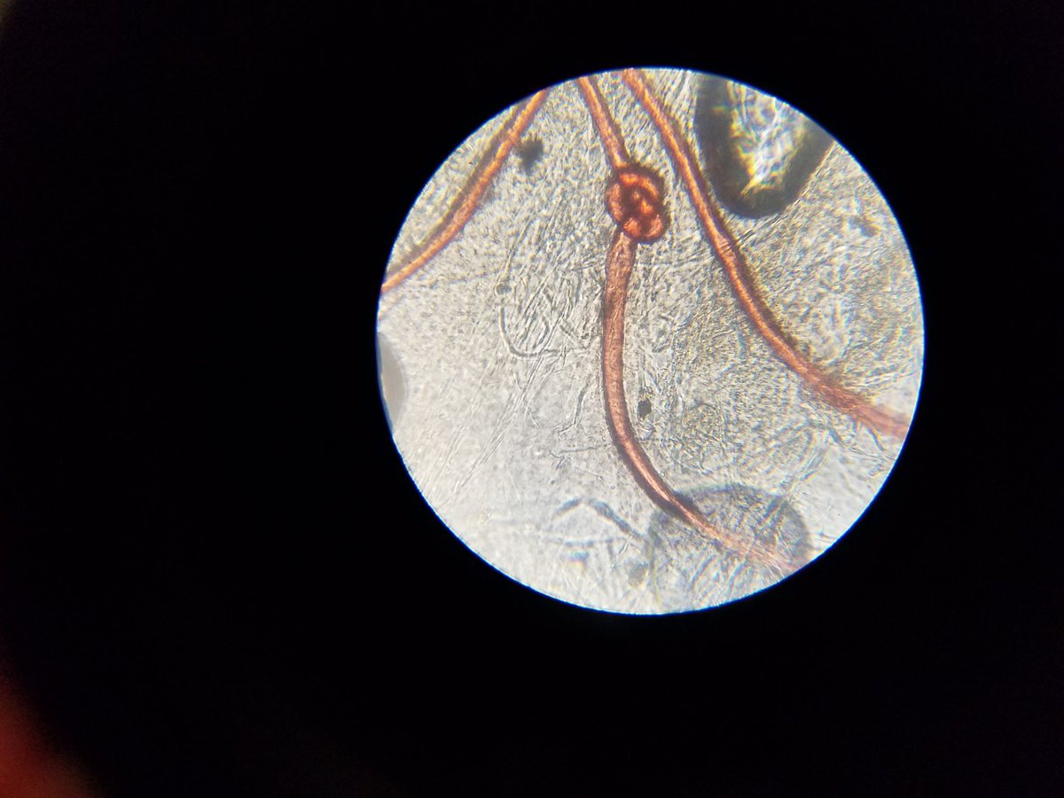 Strawberry Dna Under Microscope