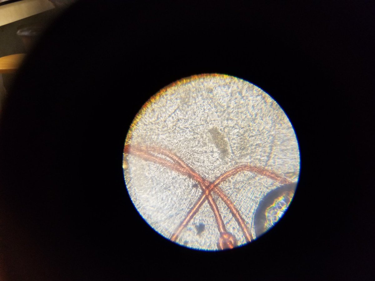 Strawberry Dna Under Microscope