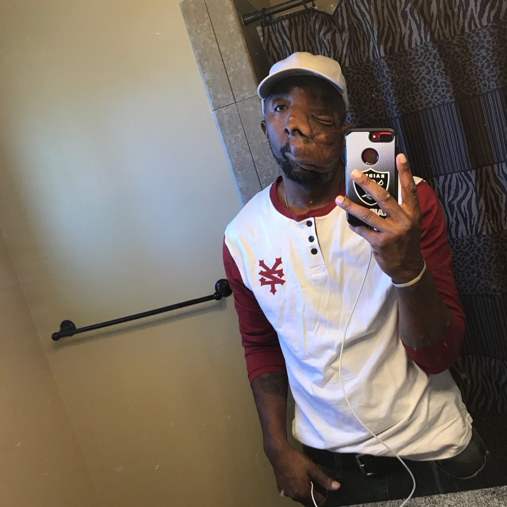 Maurice Simpson Minister Lake Invites Simpson Bay Community And