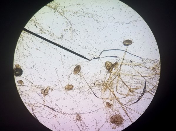 Rhizopus Stolonifer Under Microscope