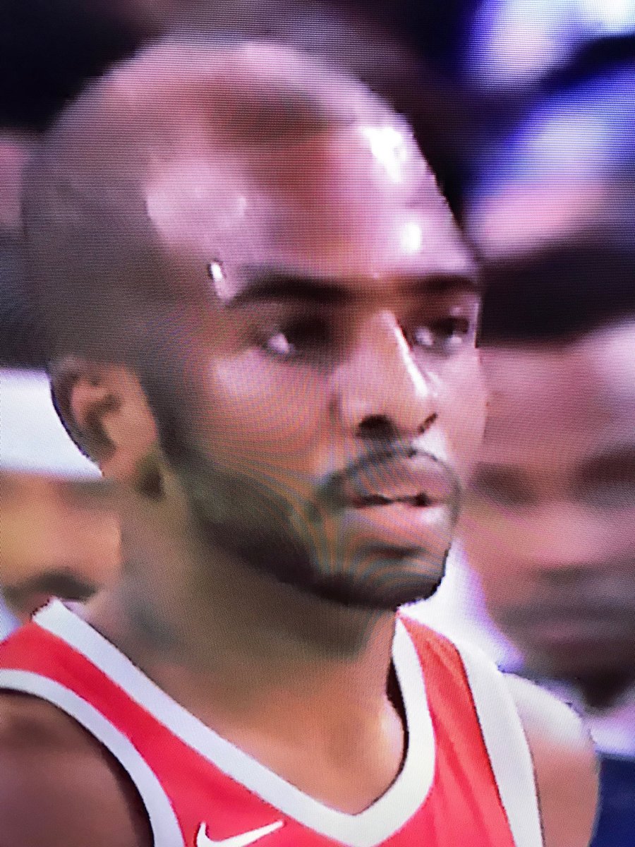 Chris Paul Hair Loss