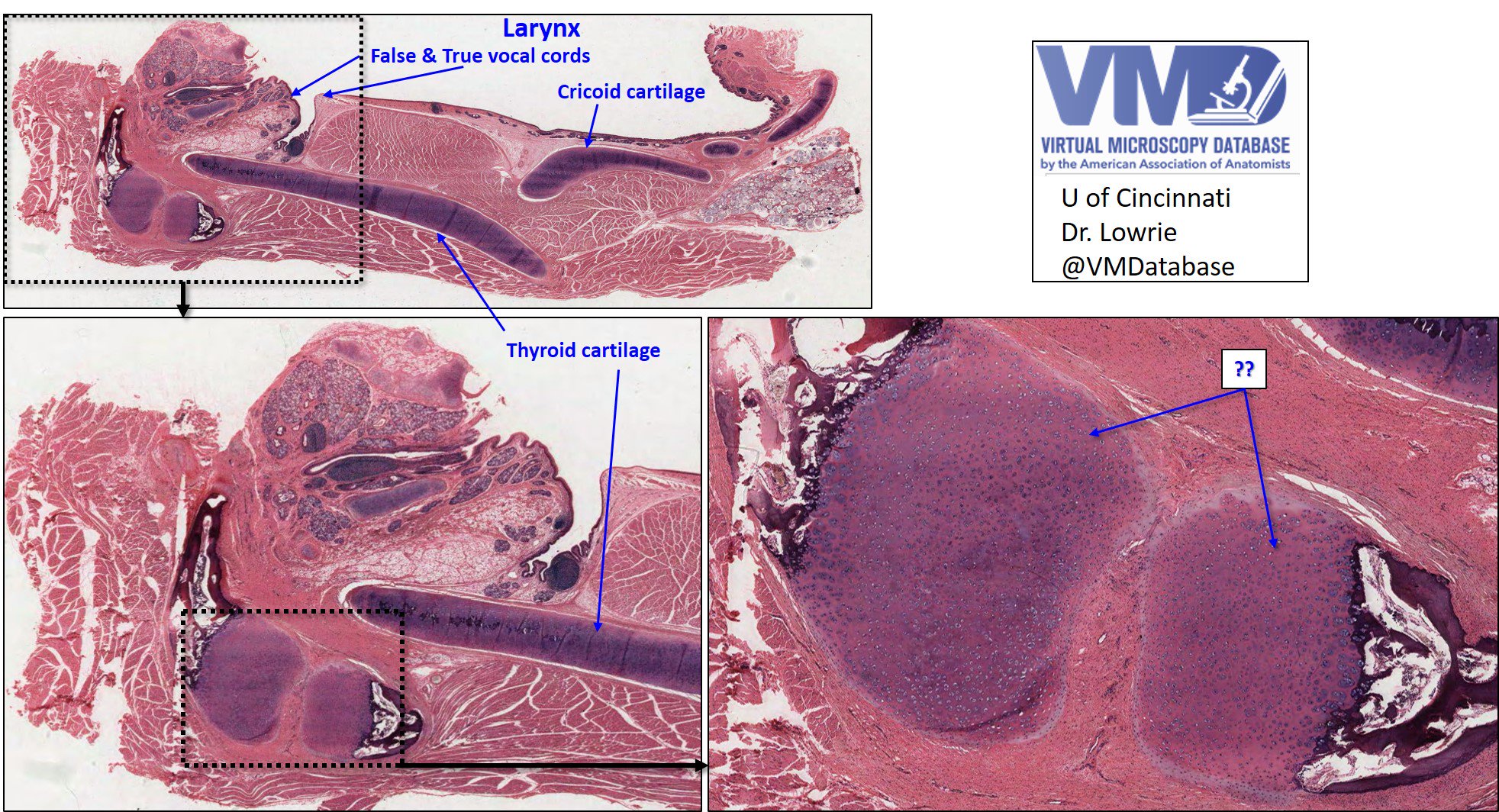 False Vocal Cords Histology