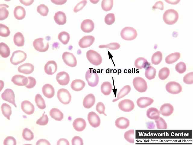 Teardrop Cell