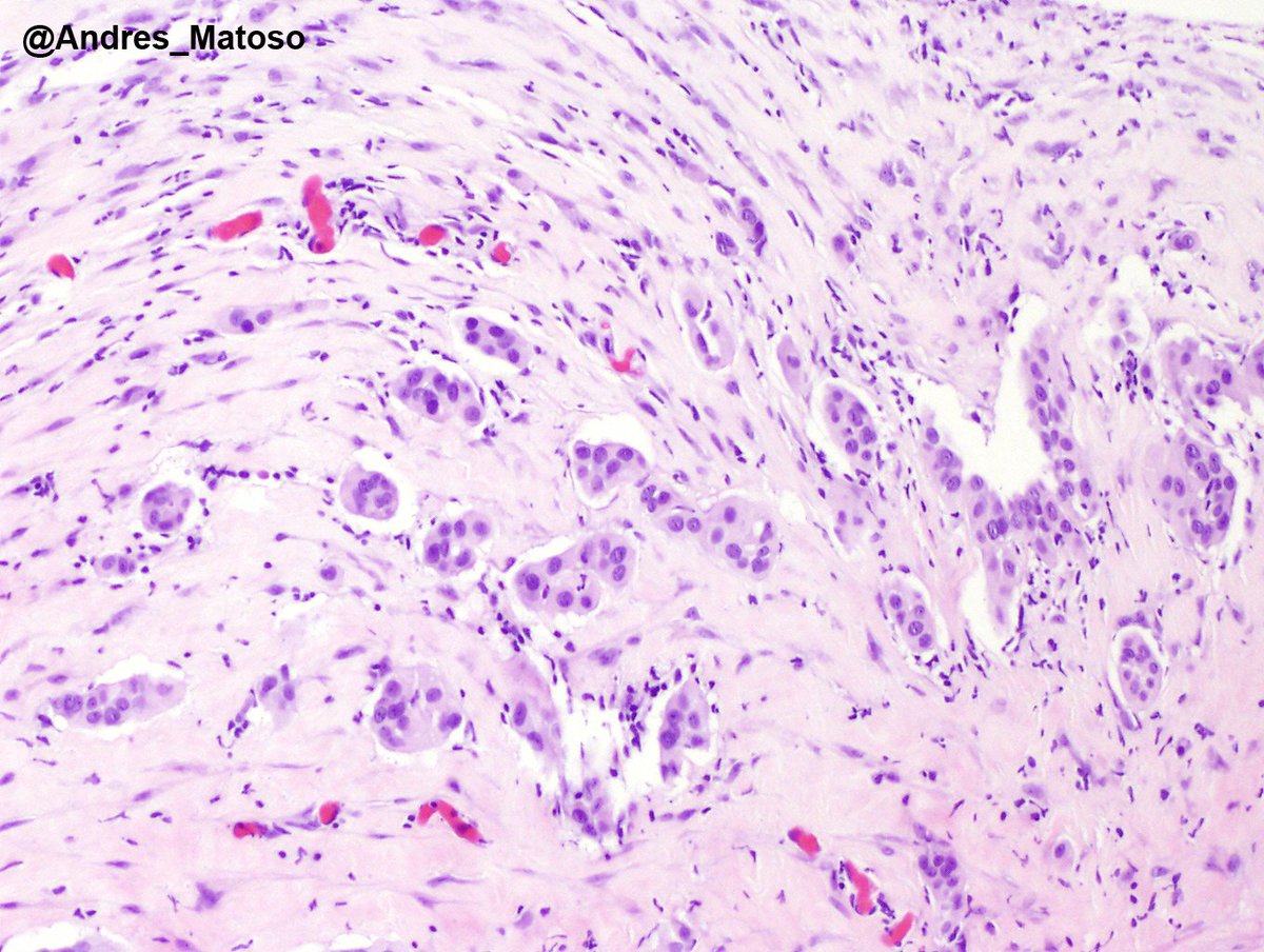 Cancer Ribbon Color Chart And Meaning