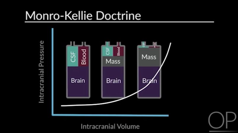 Monro Kellie Doctrine