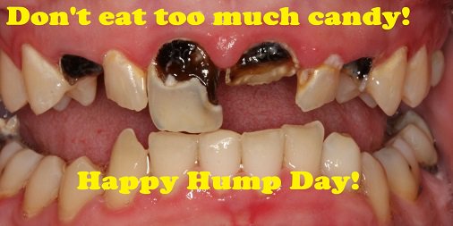 Rotten Teeth From Candy Dentures Before And After Cosmic Smile