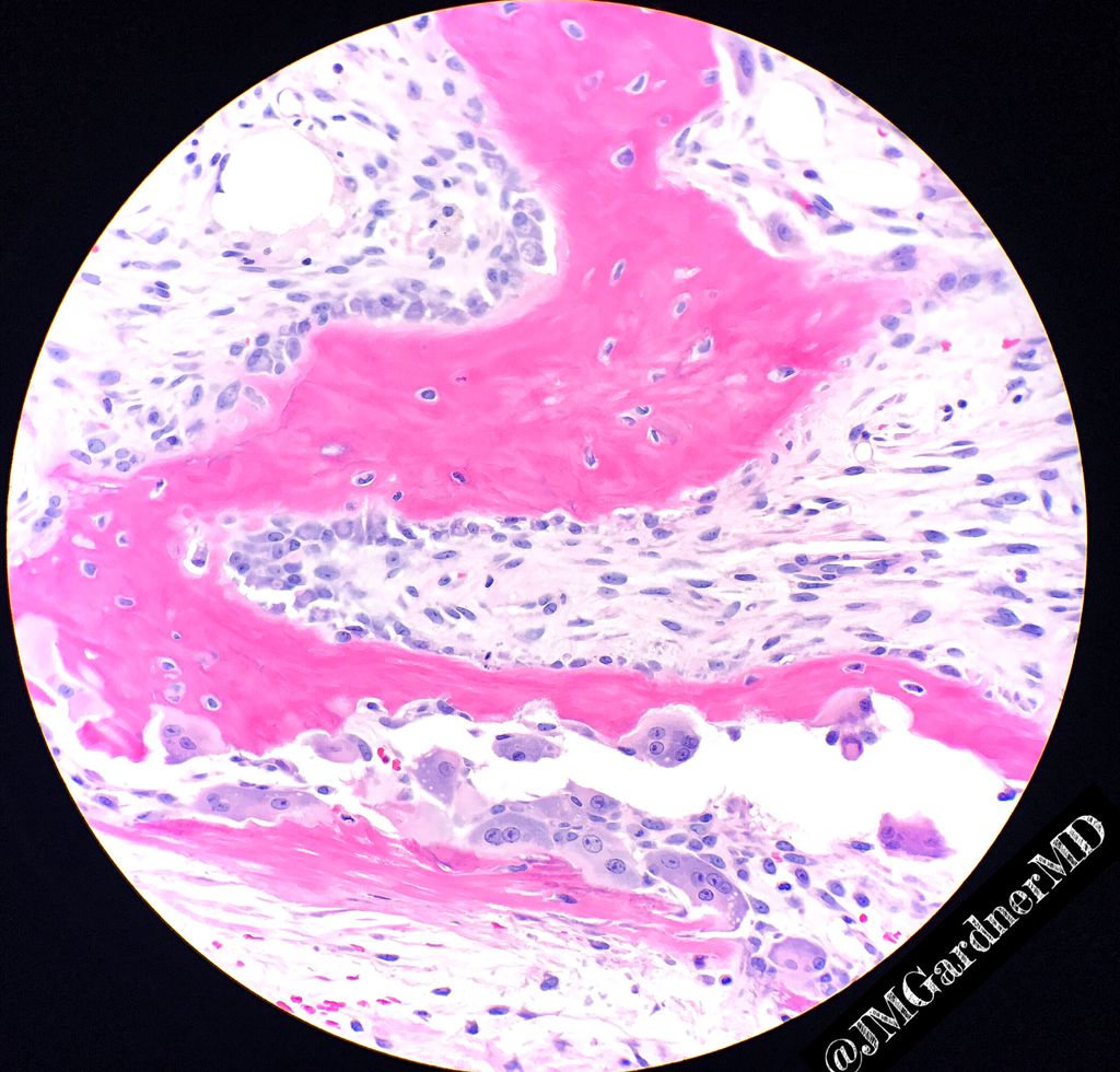 Bone Remodeling Histology