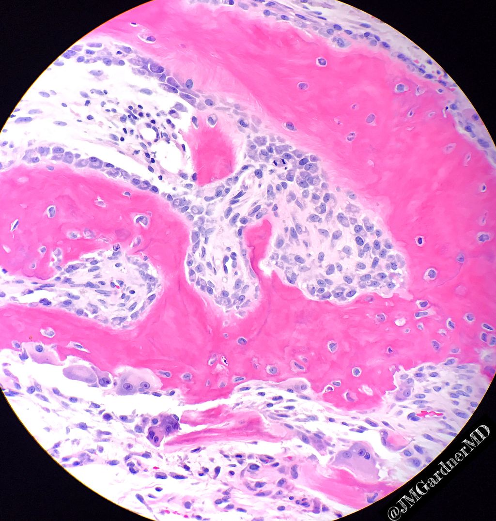 Bone Remodeling Histology