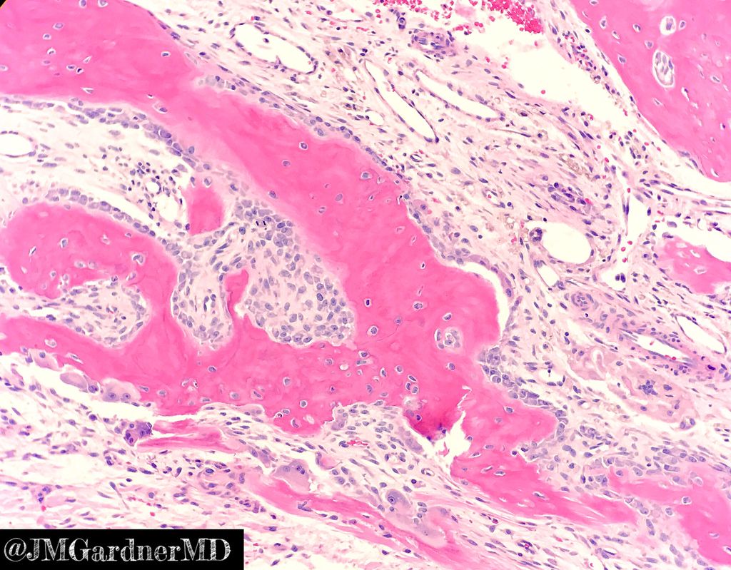 Bone Remodeling Histology