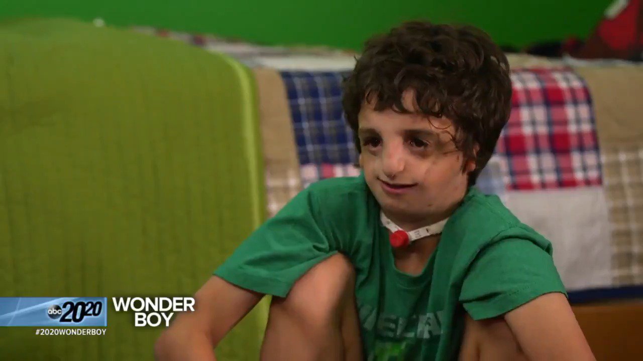 Sindrome Di Treacher Collins Nathaniel Past Productions — The Cell