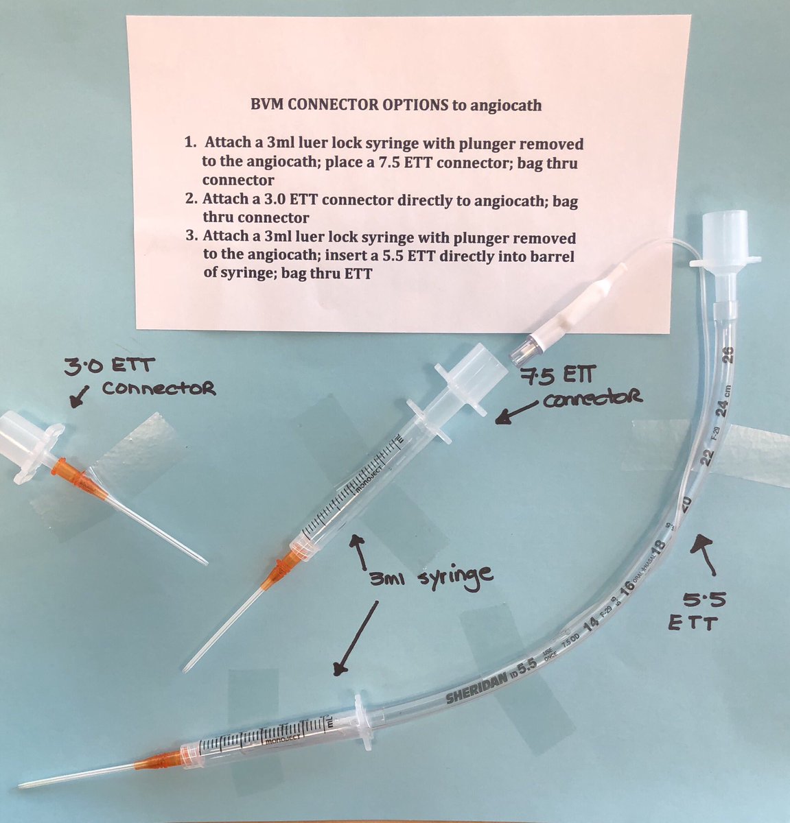 Needle Cricothyroidotomy