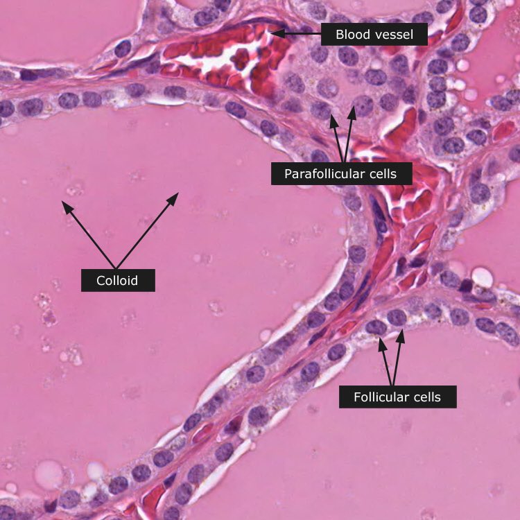 Follicular Cell Of Thyroid