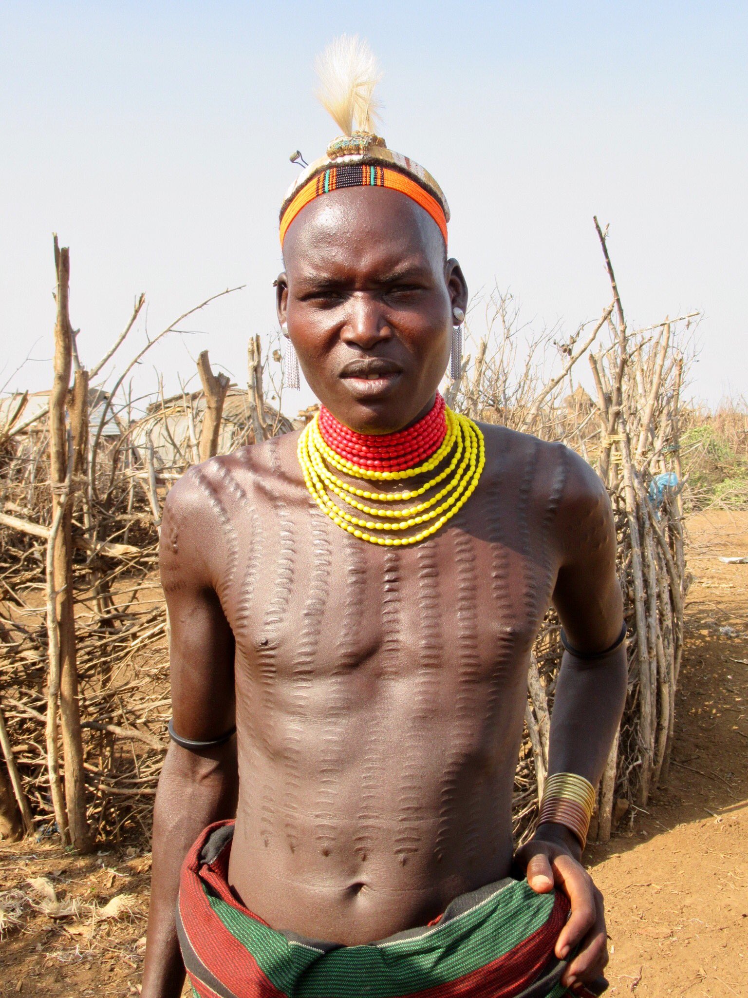 Karo Tribe Scarification
