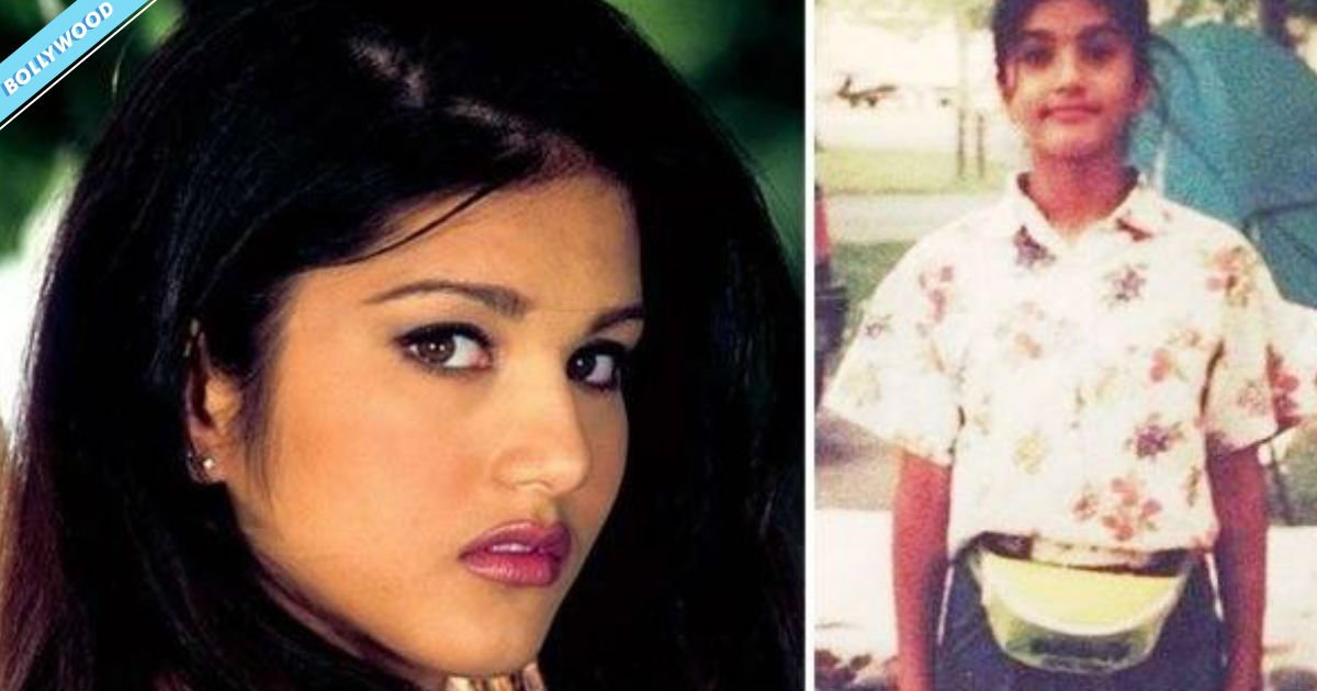 Sunny Leone Before Plastic Surgery