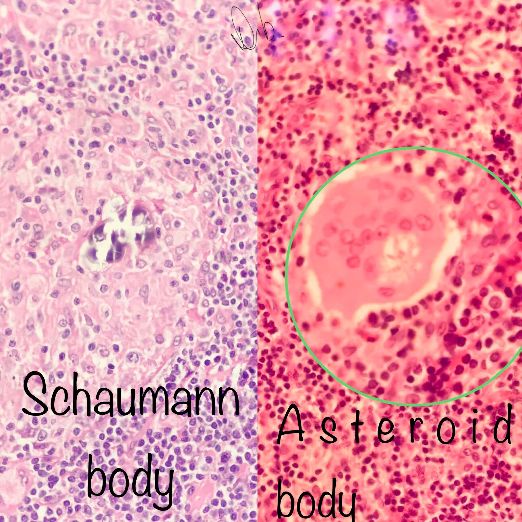 Schaumann And Asteroid Bodies