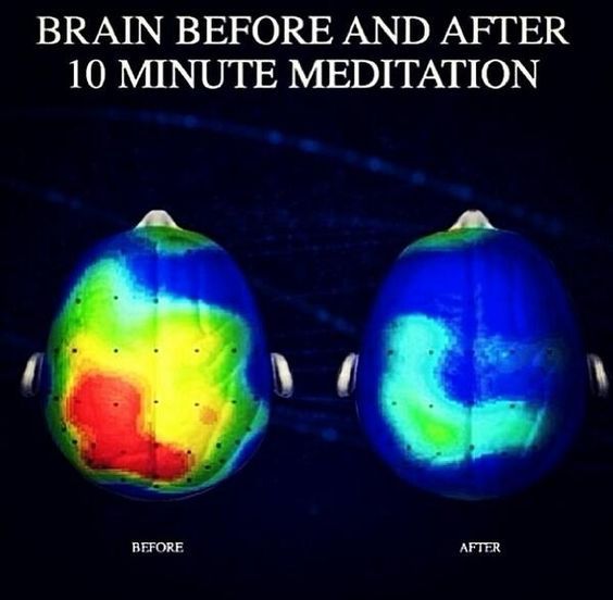 Mindfulness Brain Mri Mindfulness Brain Mri