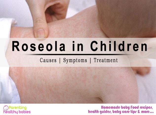 What Causes Roseola In Adults
