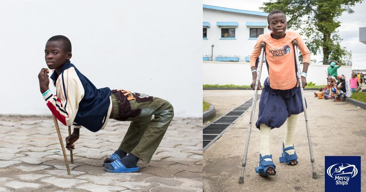 People With Backwards Legs