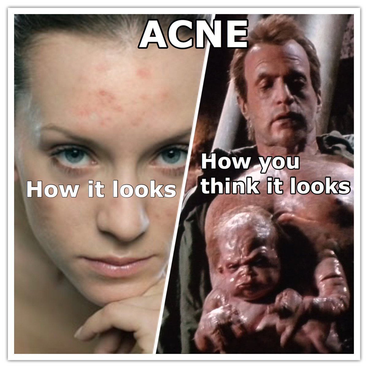 Acne Face Memes Noo It Wasn't By Accident . . . . . . #tutecomics