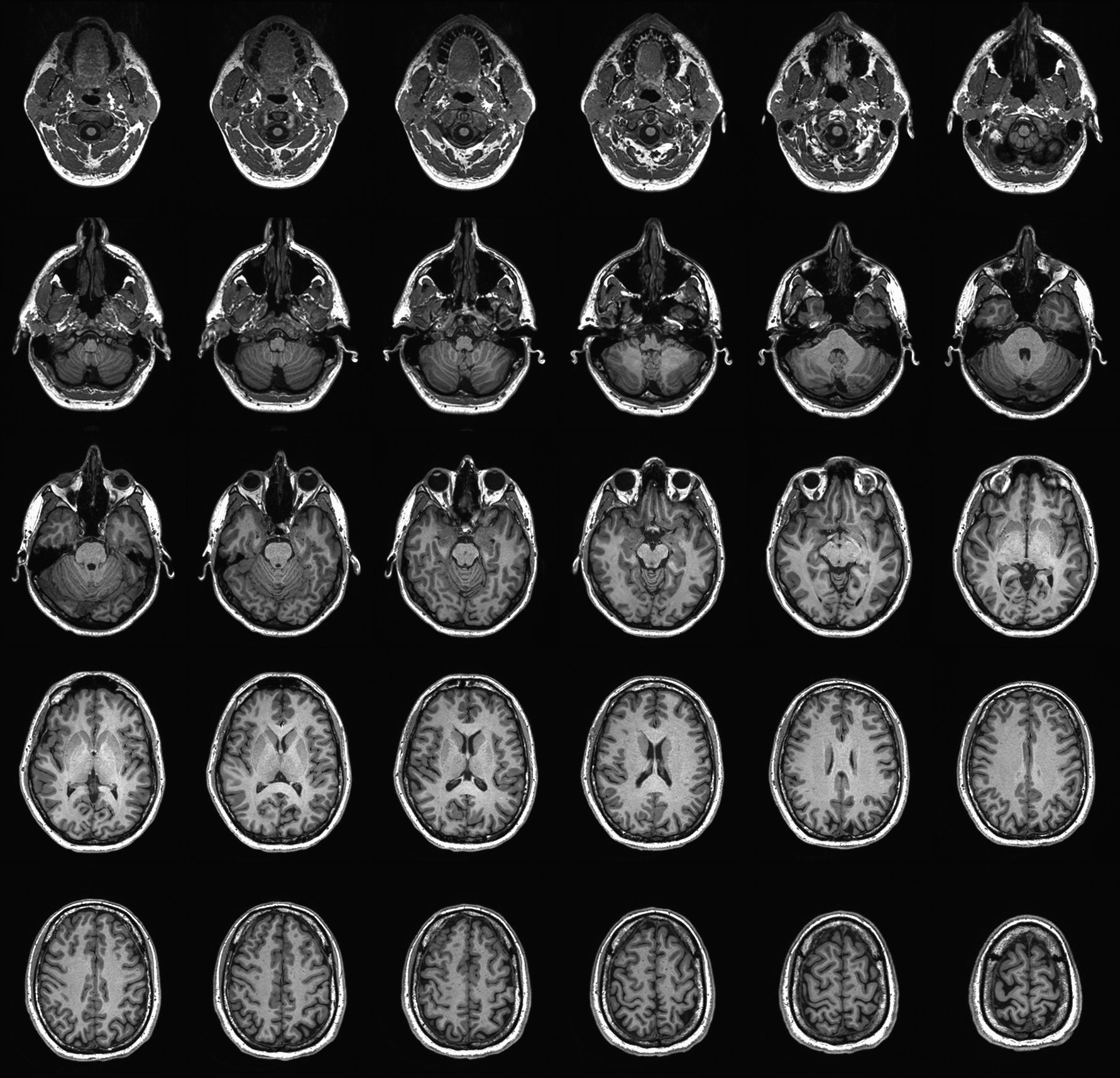 Brain Cross Sectional Atlas Imagelarge Brain Anatomy Mri Brain | My XXX ...