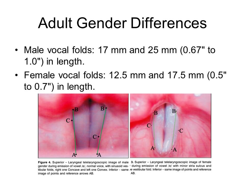 Male Vocal Chords