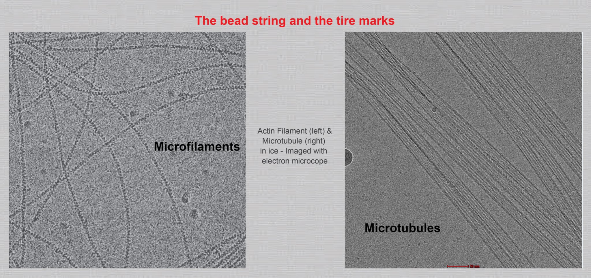 Microfilaments Electron Microscopy