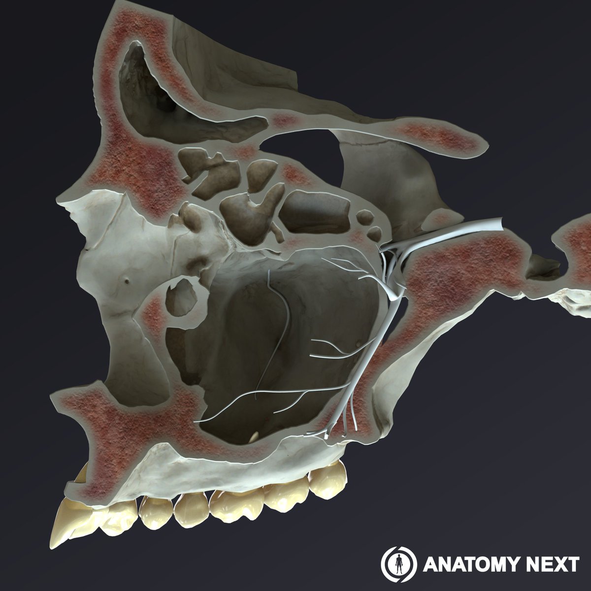Maxillary Sinus 3d