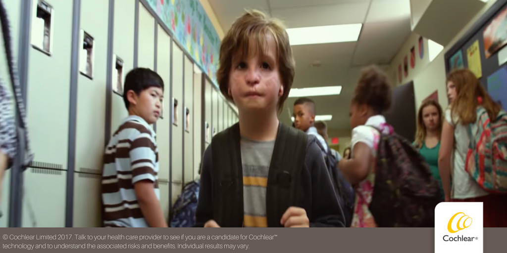 Treacher Collins Syndrome Wonder