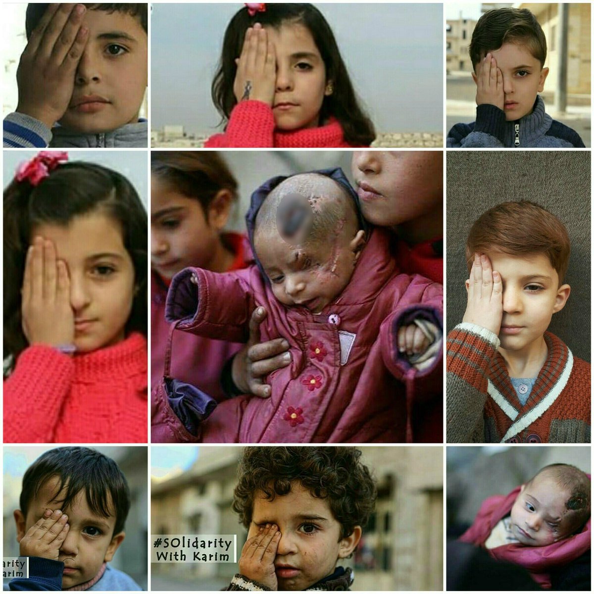 #SolidarityWithKarim: Blinded in one eye, Syrian baby becomes symbol of ...