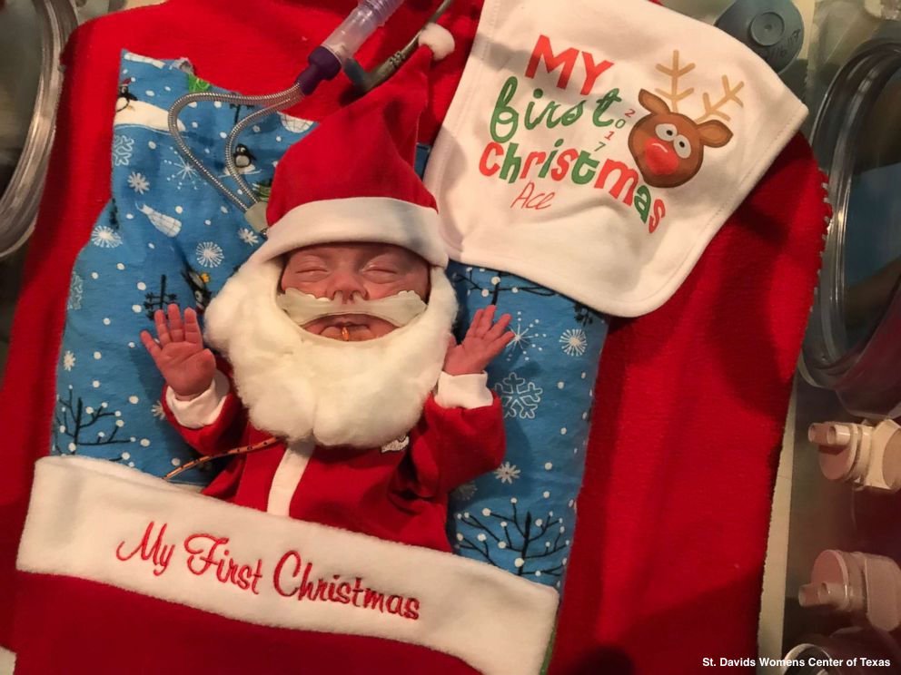 Hospital employee dresses as Santa Claus and visits nearly 50 babies in ...